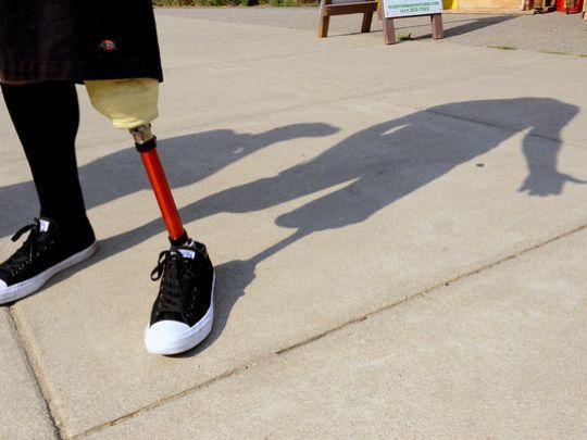 Loss of Leg on Motorcycle | The Spiva Law Group